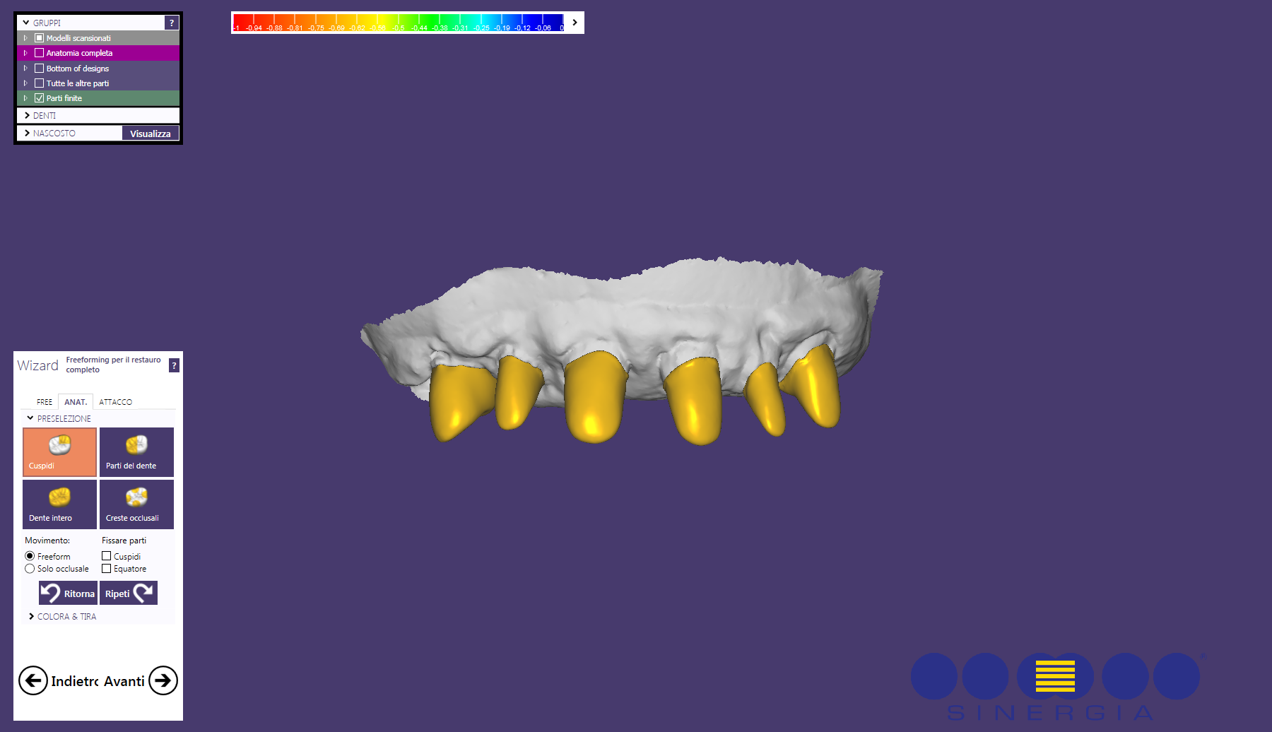 Perno moncone radicolare CAD - Dental Project
